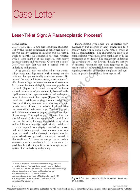 (PDF) Leser-Trélat sign: a paraneoplastic process?