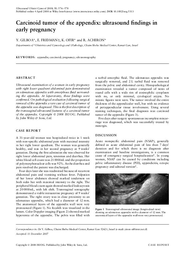 Pdf Carcinoid Tumor Of The Appendix Ultrasound Findings In Early Pregnancy
