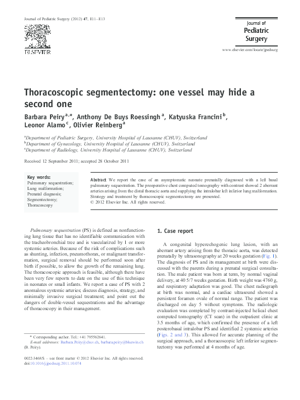 Pdf Thoracoscopic Segmentectomy One Vessel May Hide A Second One