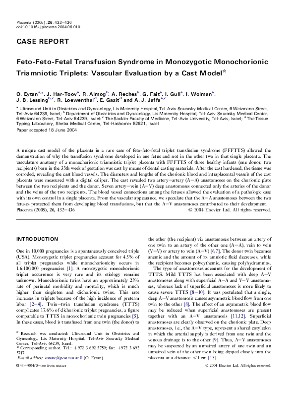 (PDF) Feto-feto-fetal transfusion syndrome in monozygotic monochorionic ...