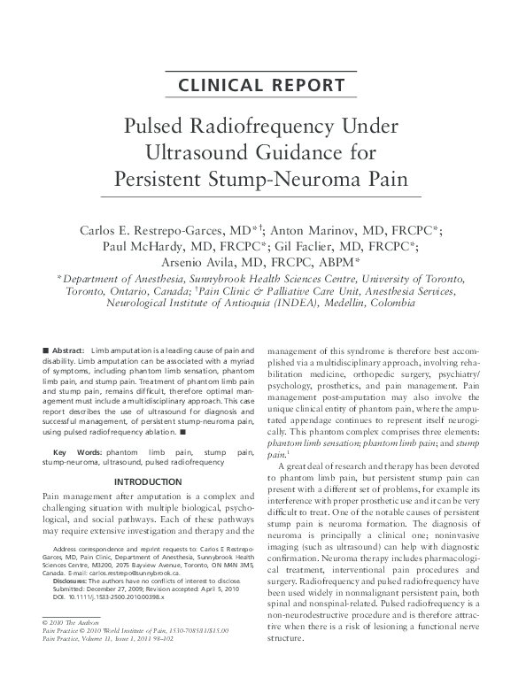 (PDF) Pulsed Radiofrequency Under Ultrasound Guidance for Persistent Stump-Neuroma Pain