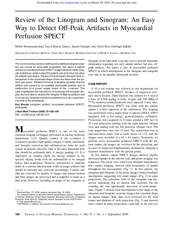 (PDF) Review of the Linogram and Sinogram: An Easy Way to Detect Off ...