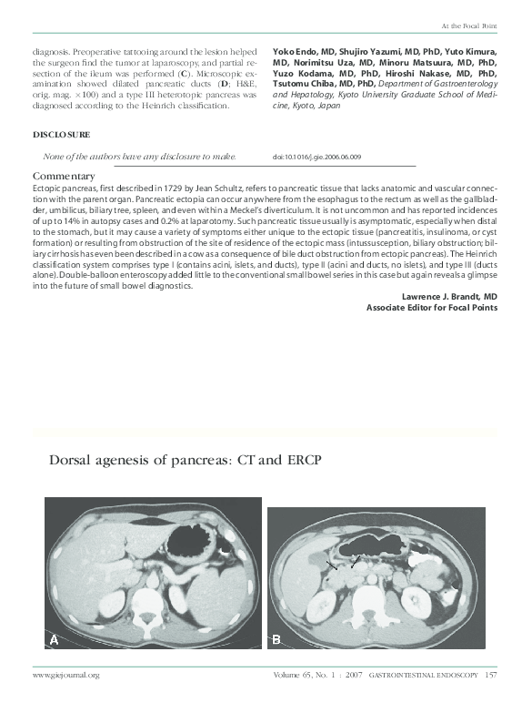 (PDF) Dorsal agenesis of pancreas: CT and ERCP