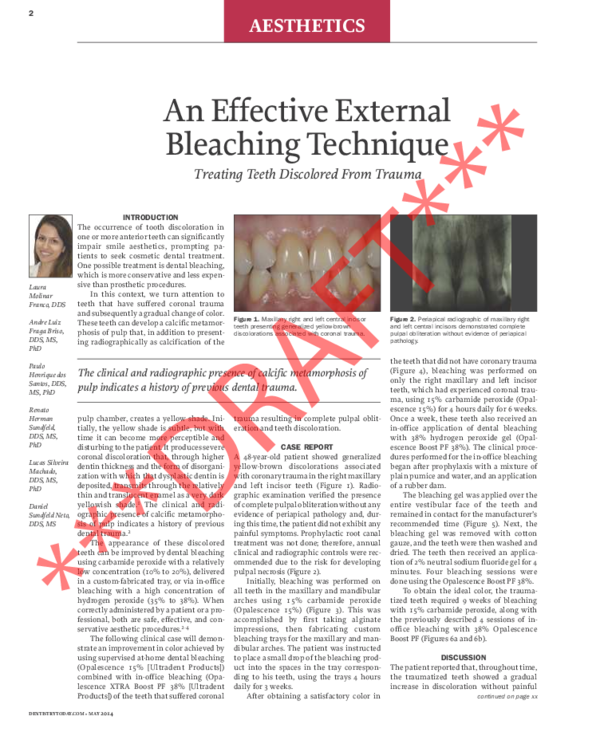 (PDF) An effective external bleaching technique