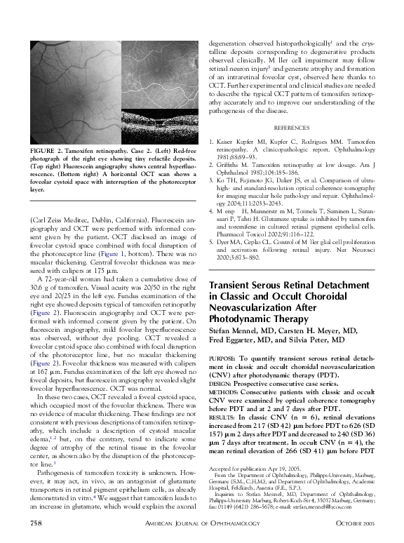 (PDF) Transient Serous Retinal Detachment in Classic and Occult ...