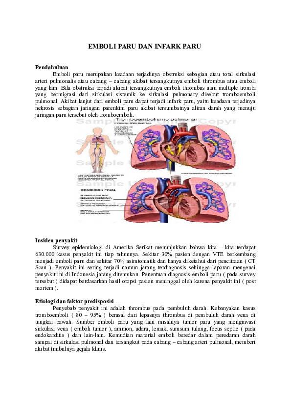 (DOC) EMBOLI PARU DAN INFARK PARU