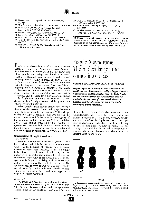 (PDF) Fragile X syndrome: The molecular picture comes into focus