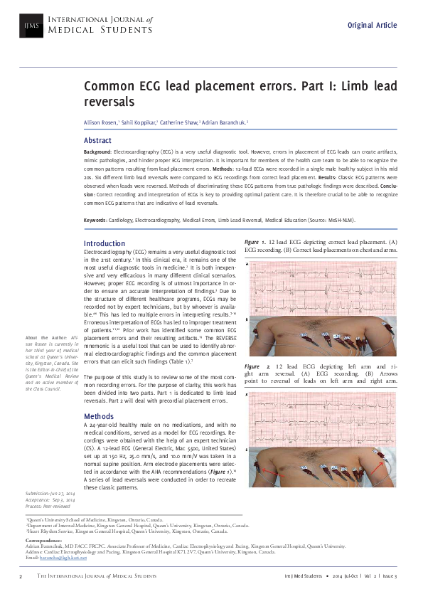 (PDF) Common ECG Lead Placement Errors. Part I: Limb Lead Reversals