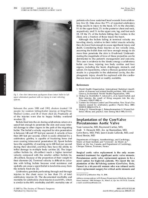 (PDF) Implantation of the CoreValve Percutaneous Aortic Valve