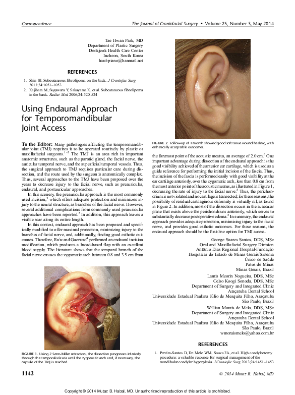 (PDF) Using Endaural Approach for Temporomandibular Joint Access