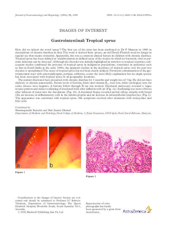 (PDF) Gastrointestinal: Tropical sprue