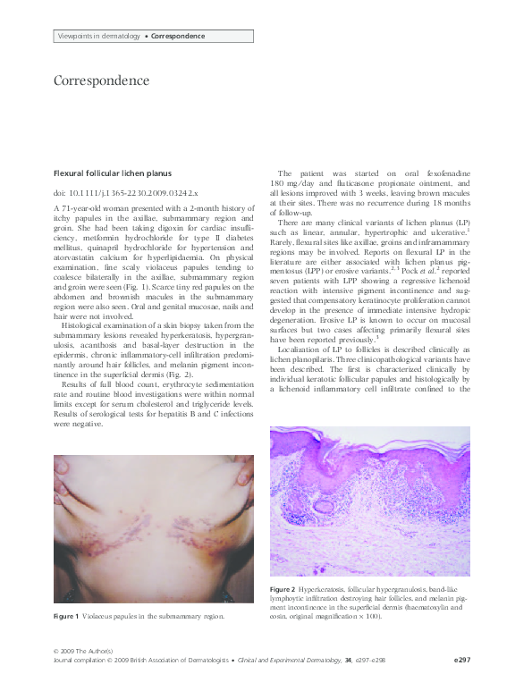 (PDF) Flexural follicular lichen planus