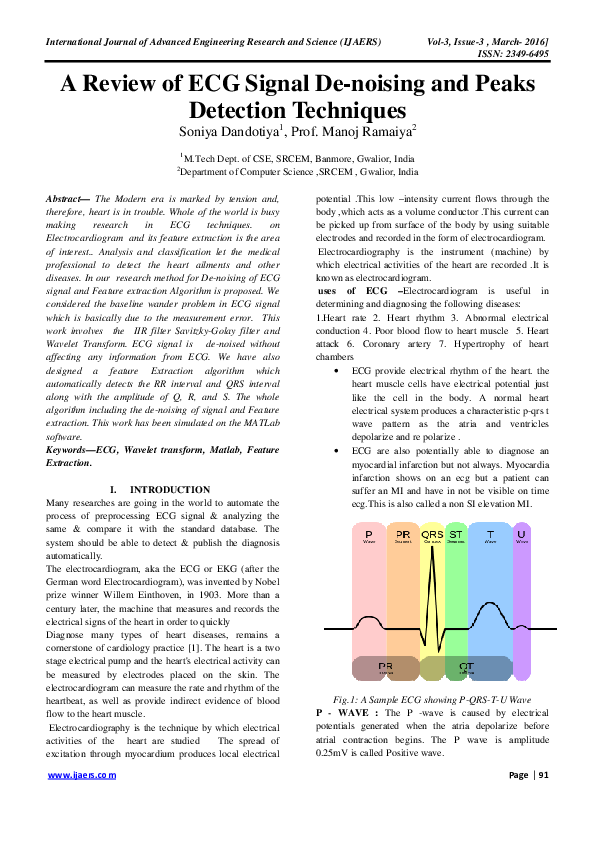 A Review Of Ecg Signal De Noising And Peaks Detection Techniques