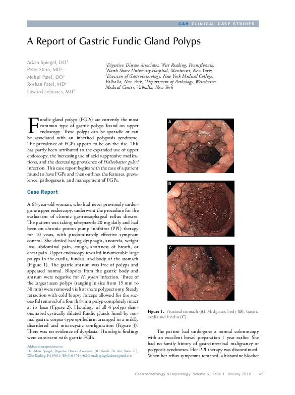 (PDF) A report of gastric fundic gland polyps