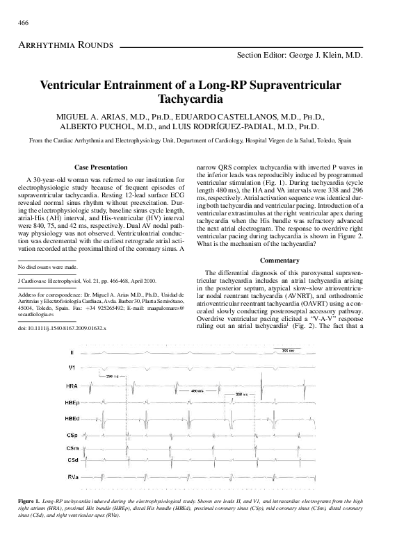 (PDF) Ventricular Entrainment of a Long-RP Supraventricular Tachycardia ...