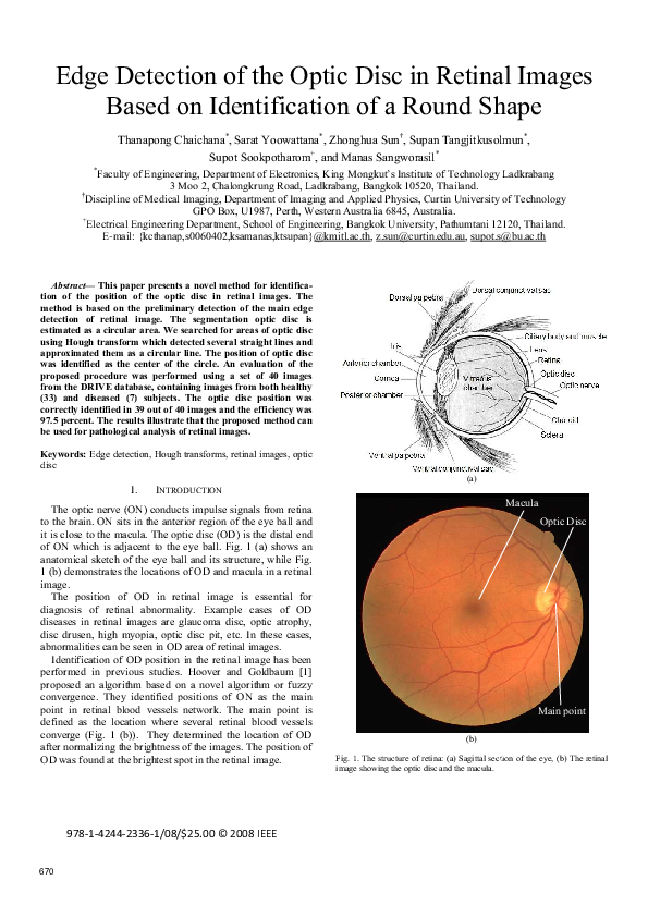 (PDF) Edge Detection of the Optic Disc In Retinal Images Based on ...