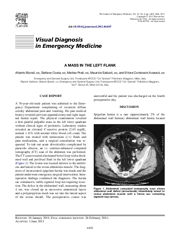 (PDF) A Mass in the Left Flank