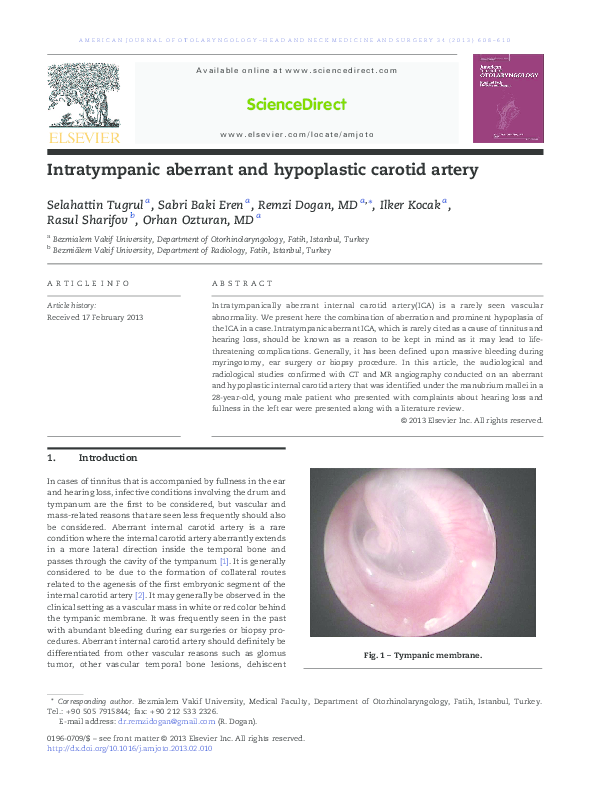 (PDF) Intratympanic aberrant and hypoplastic carotid artery