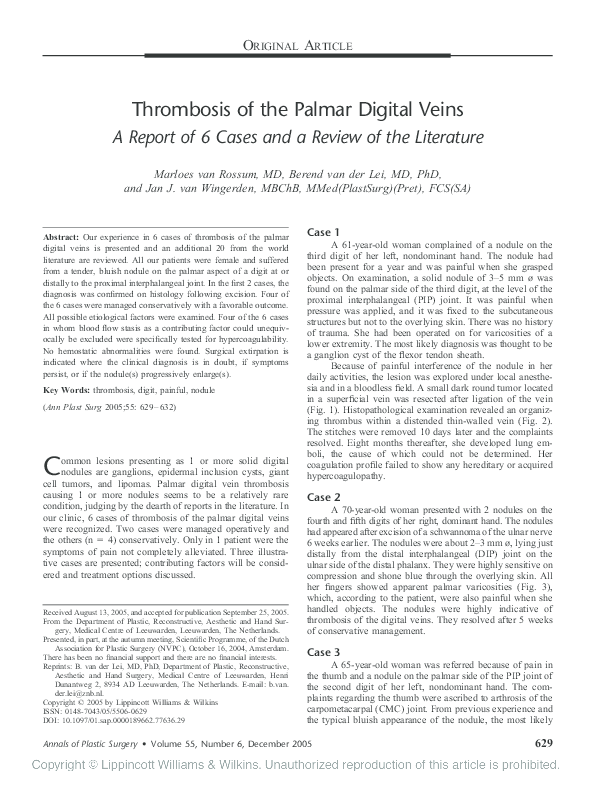 (PDF) Thrombosis of the Palmar Digital Veins