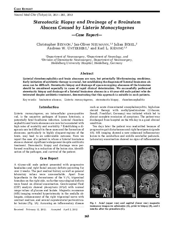 (PDF) Stereotactic biopsy and drainage of a brainstem abscess caused by ...