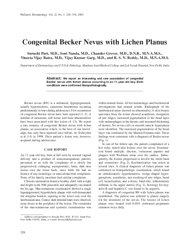 (PDF) Congenital Becker Nevus with Lichen Planus