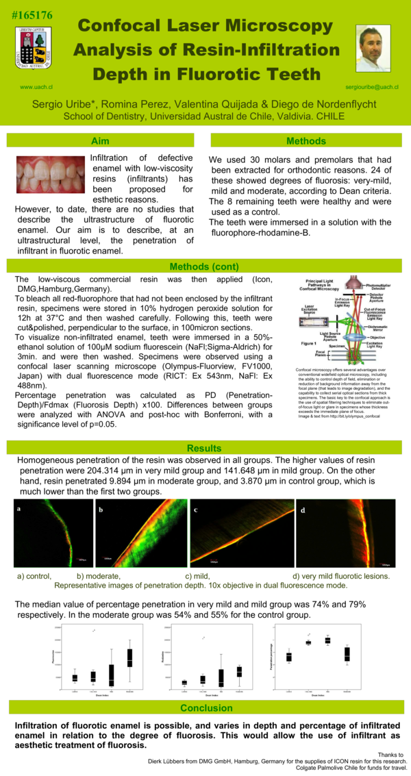 (PDF) Poster IADR 2012 Sealant Infiltration penetration fluorosis final