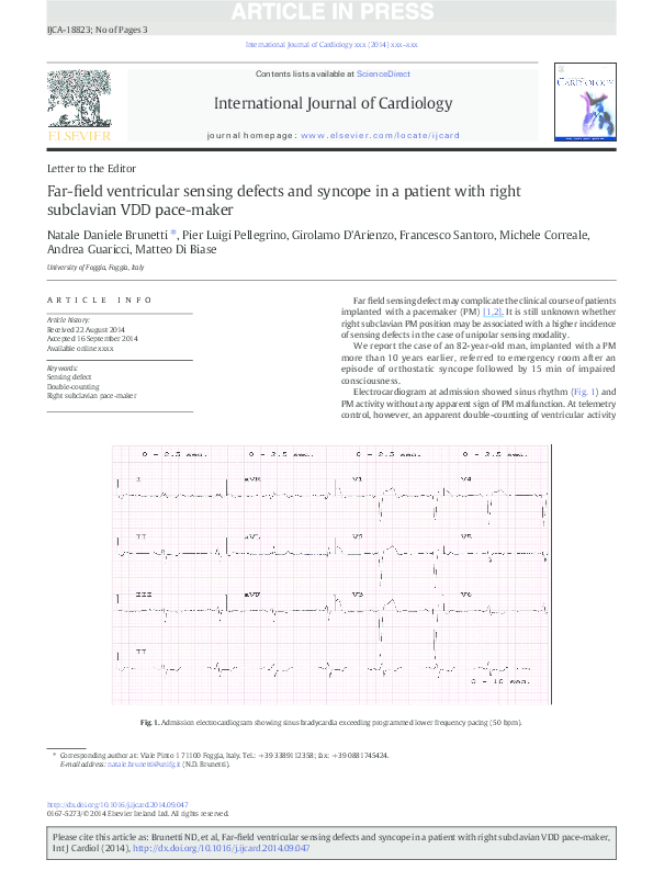 (PDF) Far-field ventricular sensing defects and syncope in a patient ...