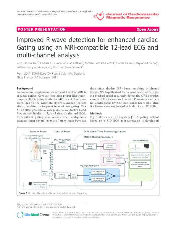 Pdf Improved R Wave Detection For Enhanced Cardiac Gating Using An