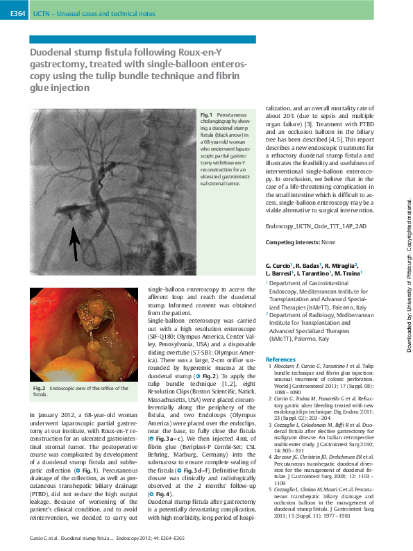 (PDF) Duodenal stump fistula following Roux-en-Y gastrectomy, treated ...