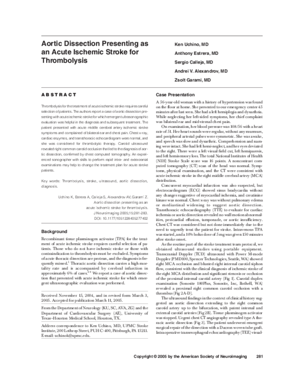 (PDF) Aortic Dissection Presenting as an Acute Ischemic Stroke for Thrombolysis
