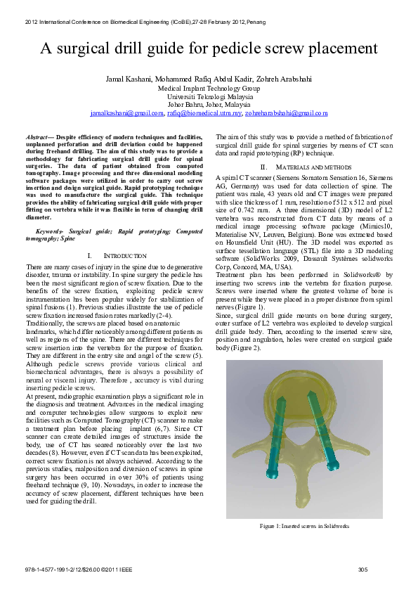 (PDF) A surgical drill guide for pedicle screw placement