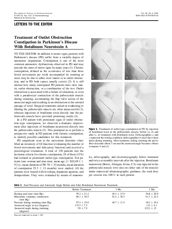 (PDF) Treatment of outlet obstruction constipation in Parkinson's ...