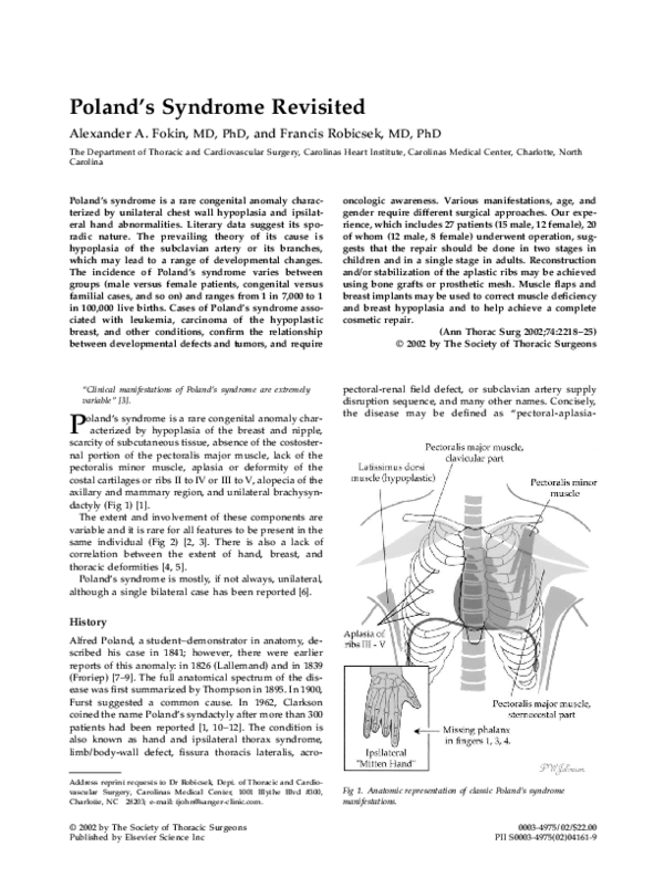 (PDF) Poland’s syndrome revisited