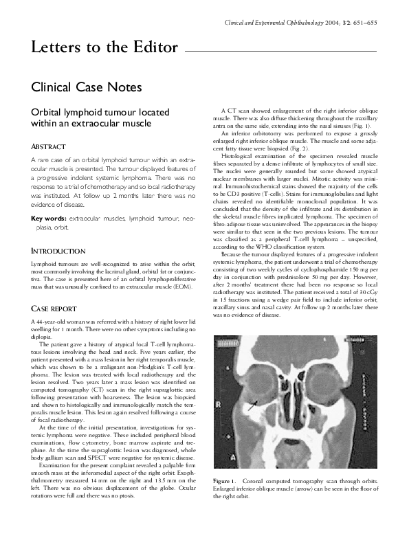 (PDF) Clinical Case Notes. Recurrent posterior capsular opacification ...