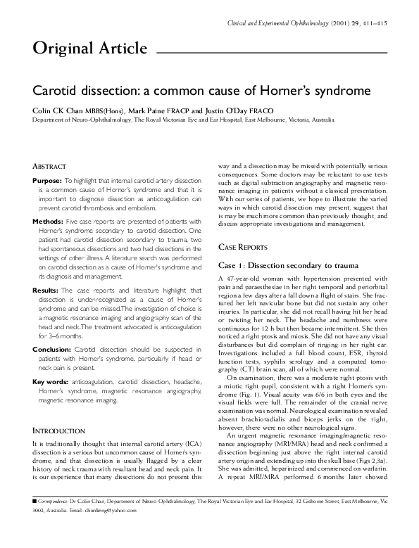(PDF) Carotid dissection: a common cause of Horner's syndrome