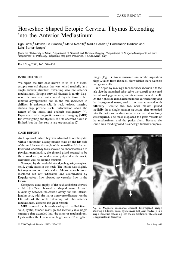 (PDF) Horseshoe Shaped Ectopic Cervical Thymus Extending into the ...