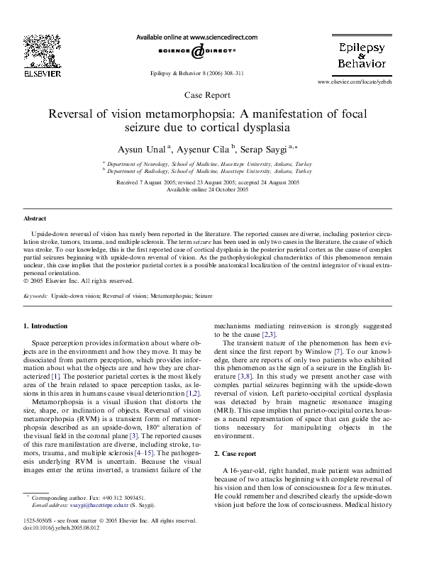 (PDF) Reversal of vision metamorphopsia: A manifestation of focal ...
