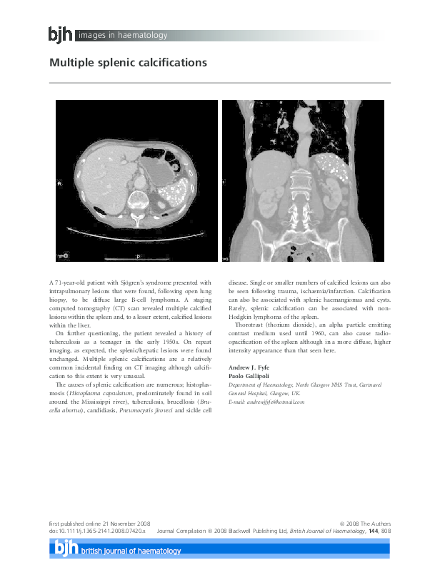(PDF) Multiple splenic calcifications