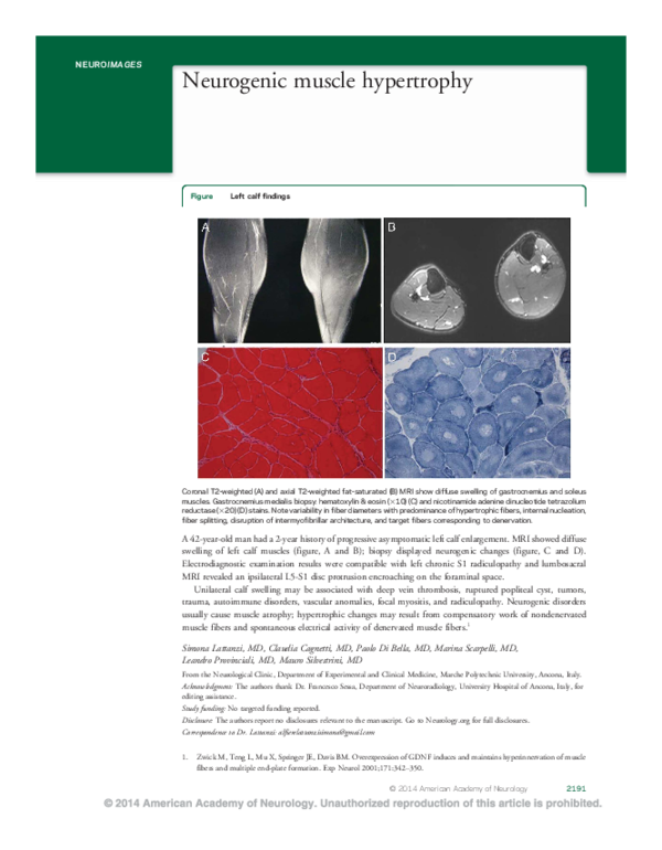 (PDF) Neurogenic muscle hypertrophy