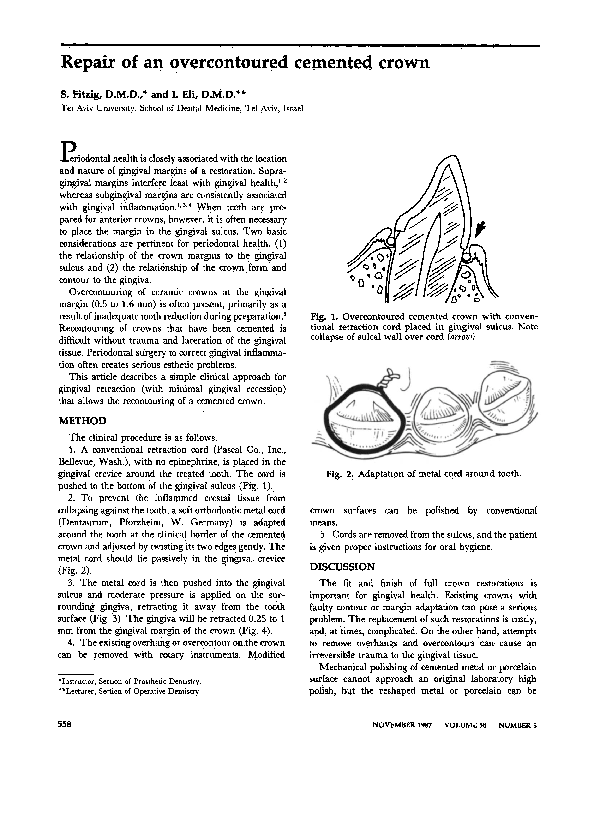 (PDF) Repair of an overcontoured cemented crown