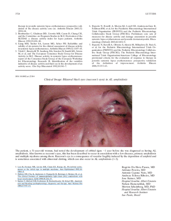(PDF) Clinical Image: Bilateral black eyes (raccoon's eyes) in AL ...
