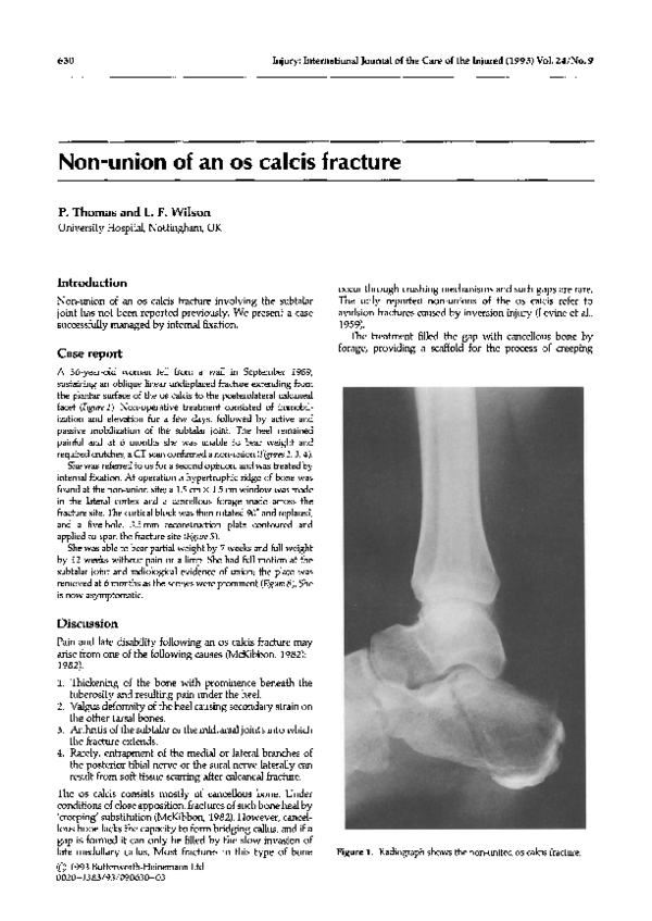 (PDF) Non-union of an os calcis fracture | Lester Wilson - Academia.edu