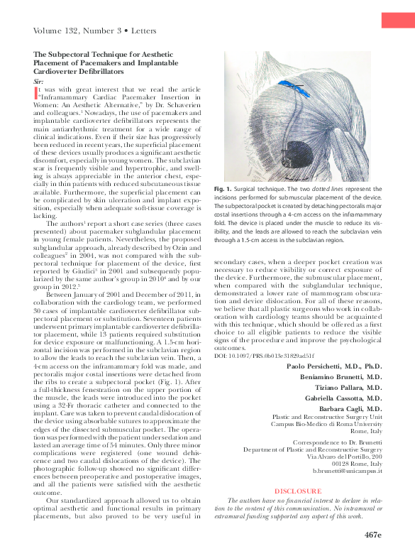 (PDF) The Subpectoral Technique for Aesthetic Placement of Pacemakers ...