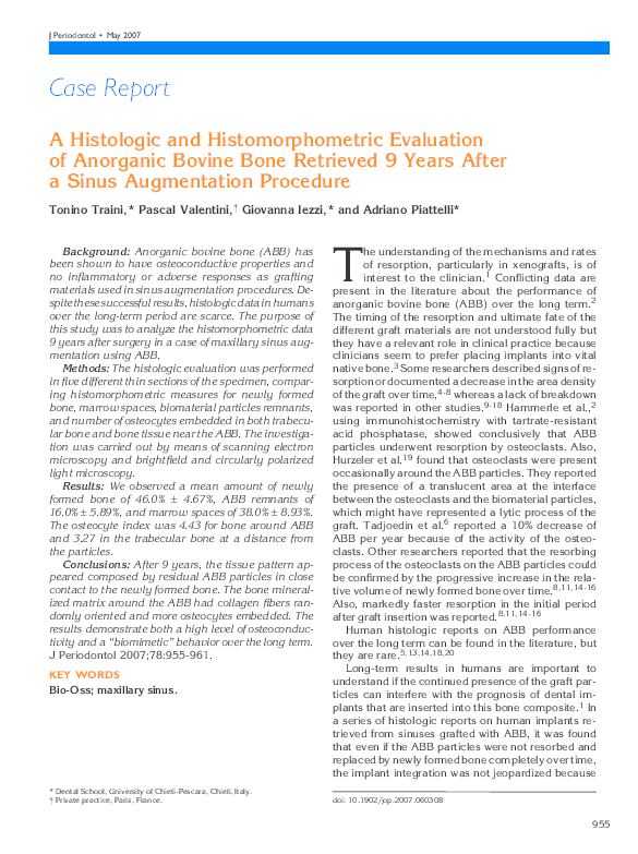 (PDF) Histologic and Histomorphometric Evaluation of Alveolar Ridge Augmentation Using Bone ...