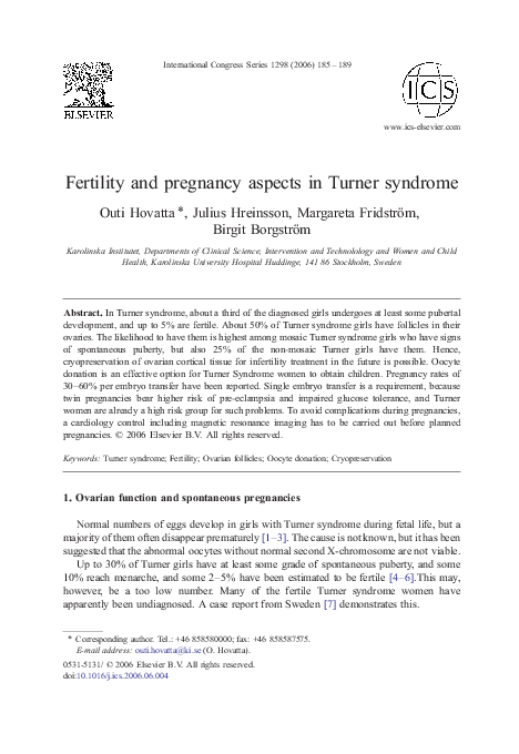 (PDF) Síndrome de Turner Twin pregnancy in a woman with Turner ’ s ...