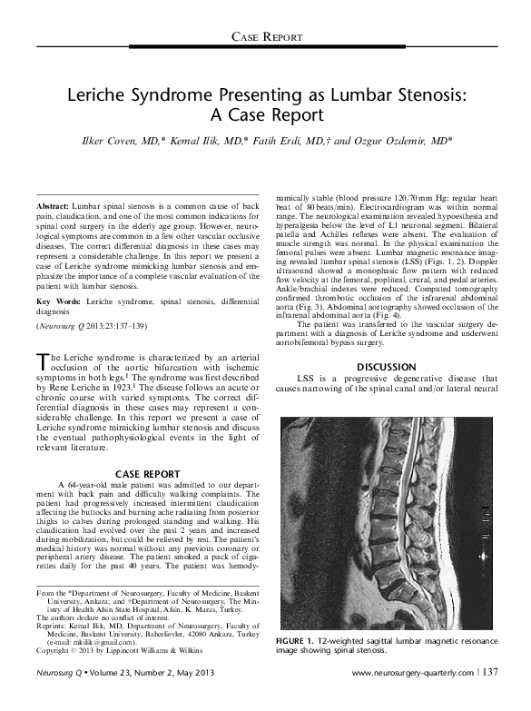 (PDF) Leriche Syndrome Presenting as Lumbar Stenosis