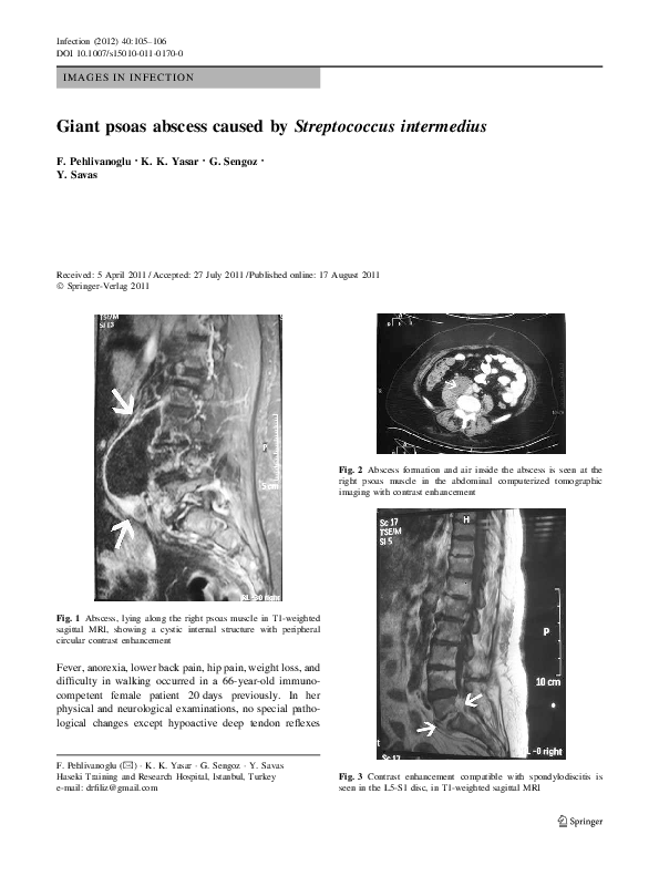 (PDF) Giant psoas abscess caused by Streptococcus intermedius