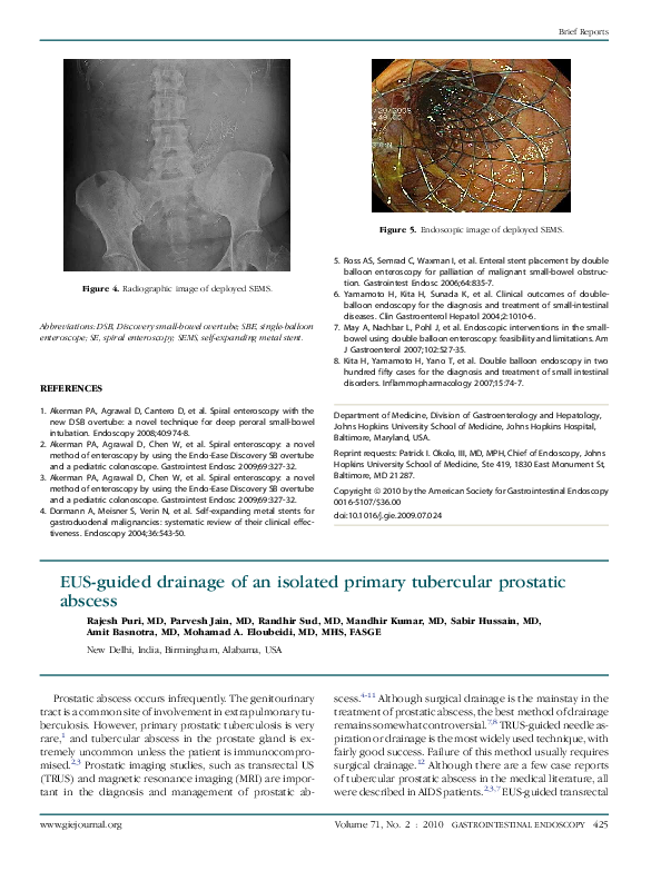 (PDF) EUS-guided drainage of an isolated primary tubercular prostatic ...