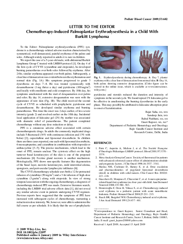 (PDF) Chemotherapy-induced palmoplantar erythrodysesthesia in a child ...