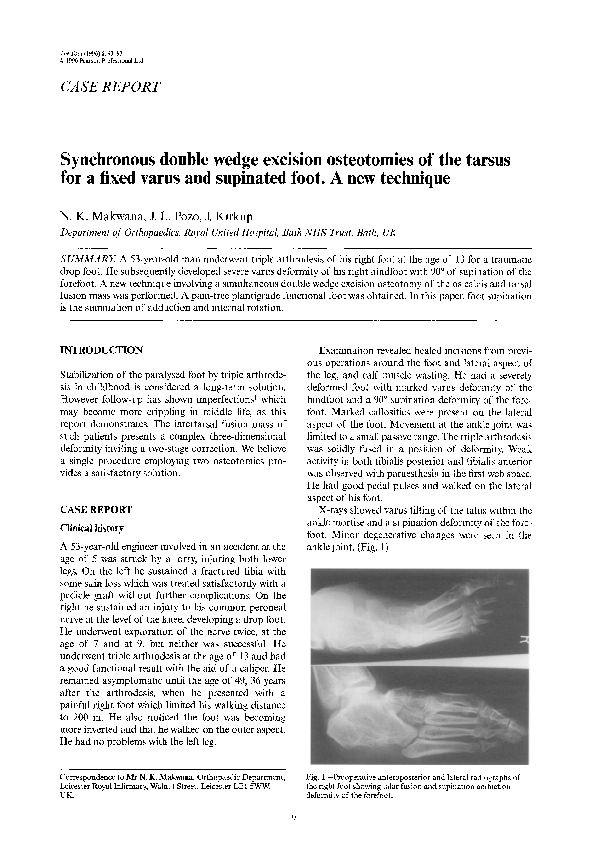 (PDF) Synchronous double wedge excision osteotomies of the tarsus for a ...